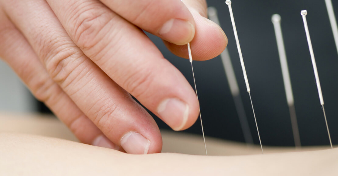 Treatments – Taigum Physiotherapy & Massage Clinic